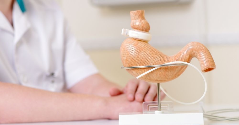 Understanding Weight Loss Surgery | St. John’s